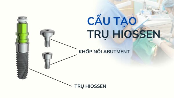 Trụ Implant Hiossen - Phục Hình Răng Chất Lượng Và Thẩm MỸ