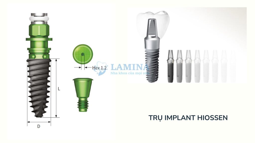Trụ Implant Hiossen - Phục Hình Răng Chất Lượng Và Thẩm MỸ